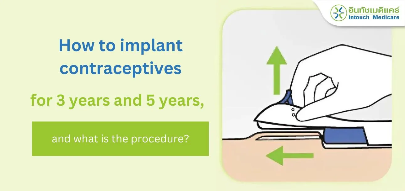 How to contraceptive implant, What are the steps? - intouchmedicare