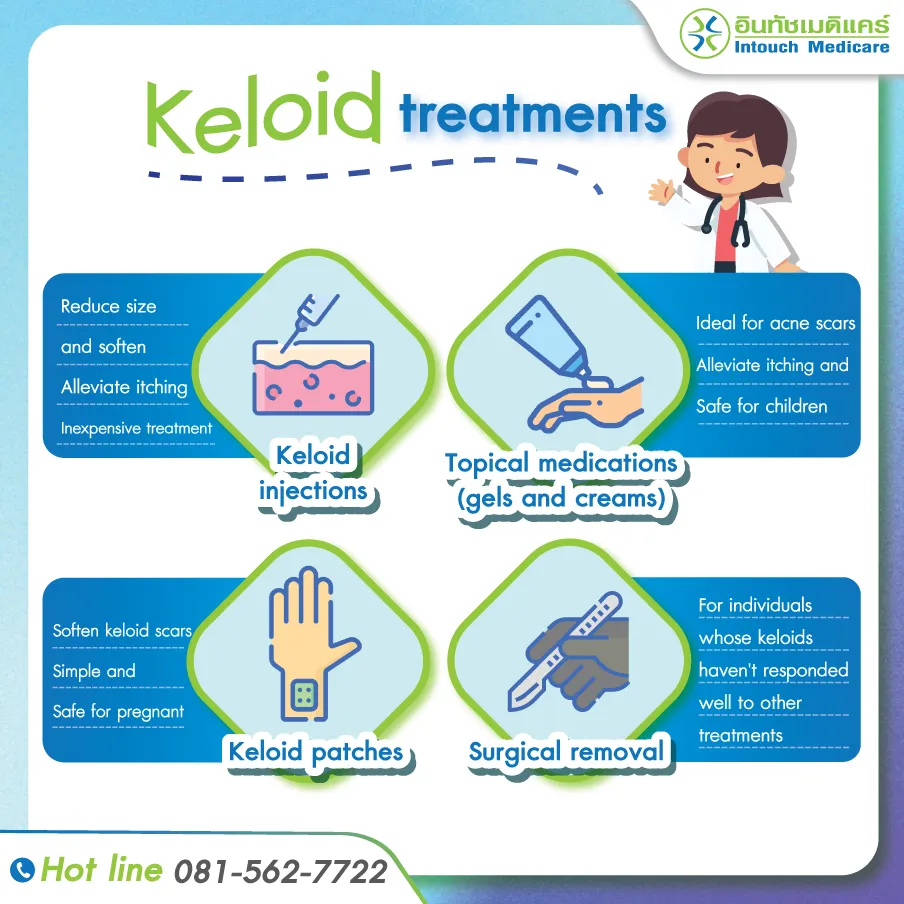 Keloids: Causes and Treatments