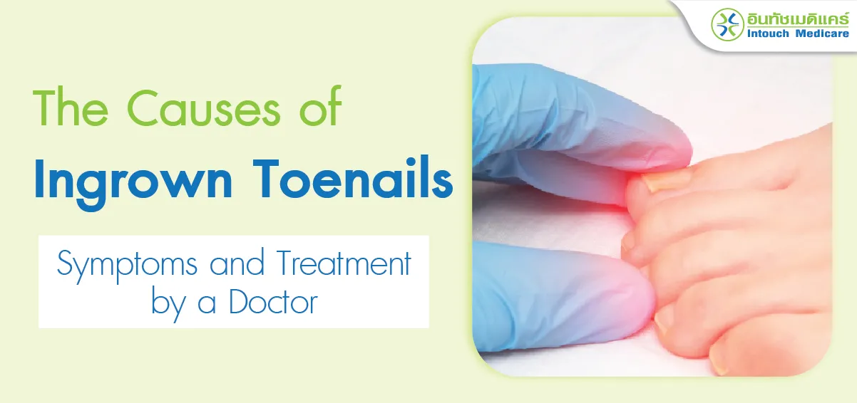 The Causes of Ingrown Toenails. Symptoms and Treatment - intouchmedicare