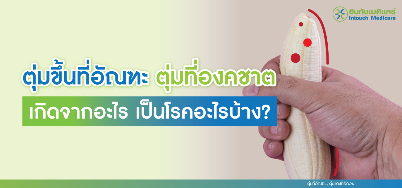 ตุ่มขึ้นที่อัณฑะ ตุ่มที่องคชาต เป็นโรคอะไรบ้าง? - intouchmedicare