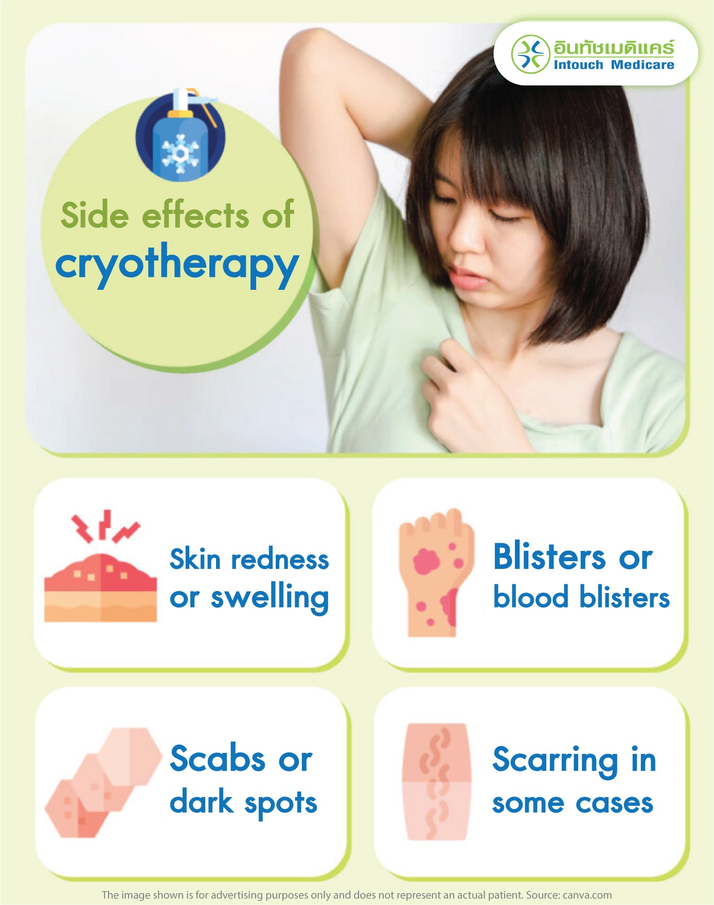 Cryotherapy (Freezing Treatment) Can Effectively Remove Warts and Skin ...