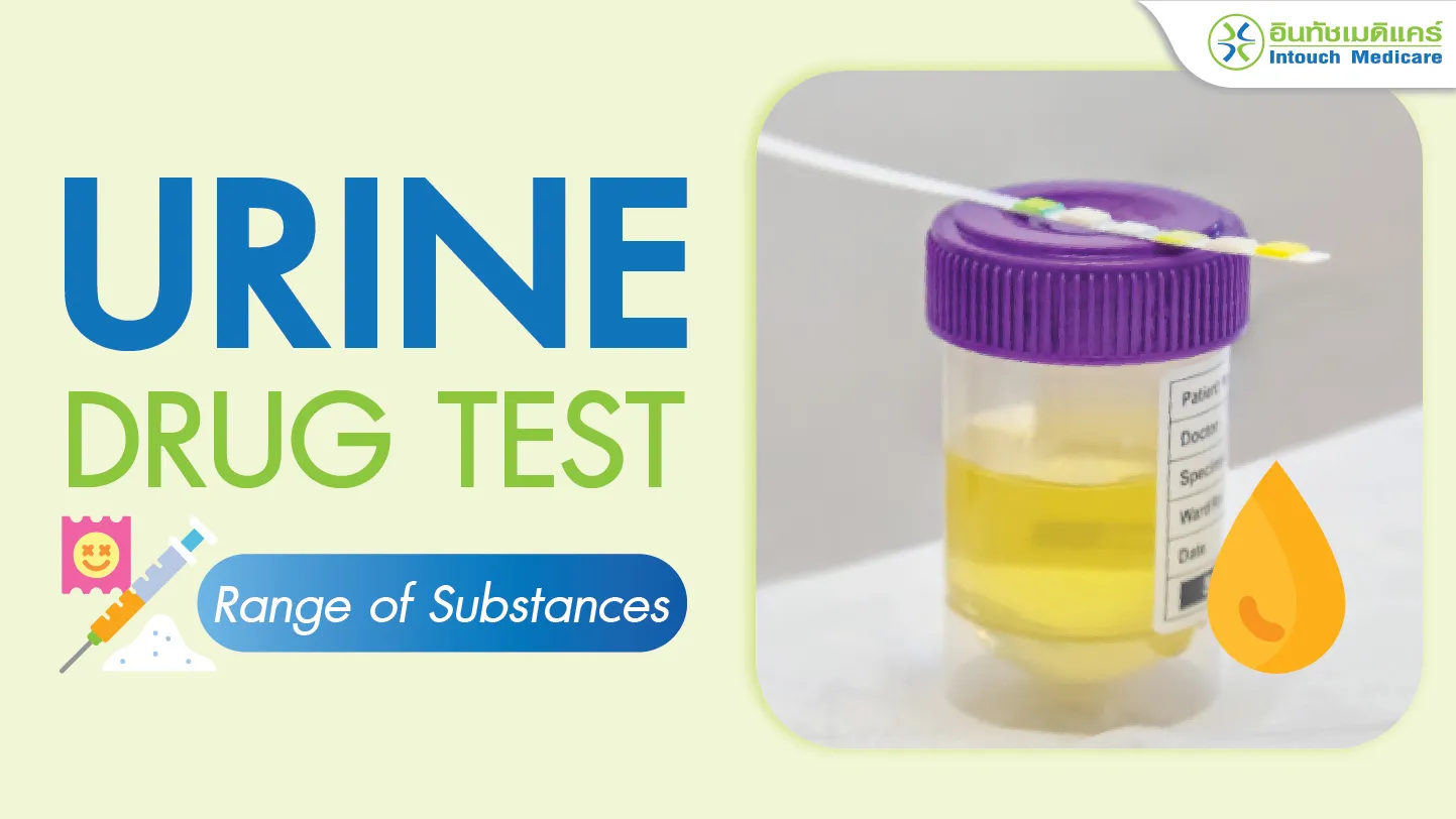 Urine Drug Test – What It Detects, How Long It Takes, Price & Preparation