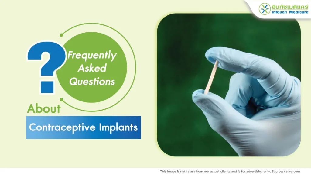 Frequently Asked Questions About Contraceptive Implants